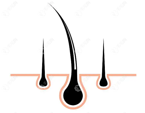 从pt88和pt66的成分和作用分析,看pt88和pt66分别适用人群有哪些 - 脱发知识 - 毛毛网